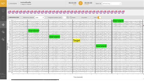 The Auditory Oddball Paradigm And Its Insights Into Cognitive Decline
