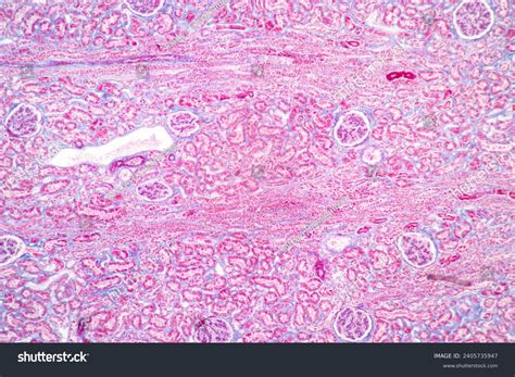 Spleen Histology Diagram Spleen Histology Diagram