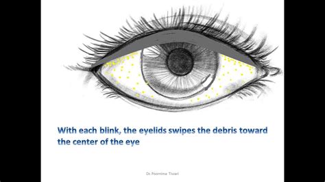 How Do ‘bitots Spots Form Explained In Hindi Psm Made Simple Youtube