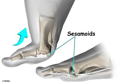 Sesamoid