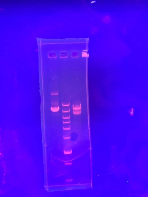 Why The Plasmid Became Smaller After Single Restriction Digestion Researchgate