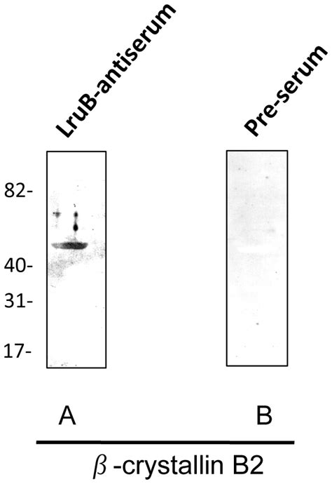 Lrub Antiserum Reacts With Human β Crystallin B2 A Immunoblots