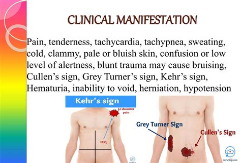 Abdominal Injury Pptx
