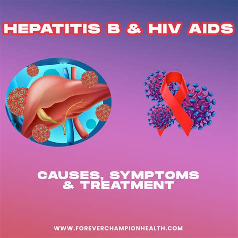 Hepatitis B And Hivaids Symptomsdiagnosis And Treatment Forever