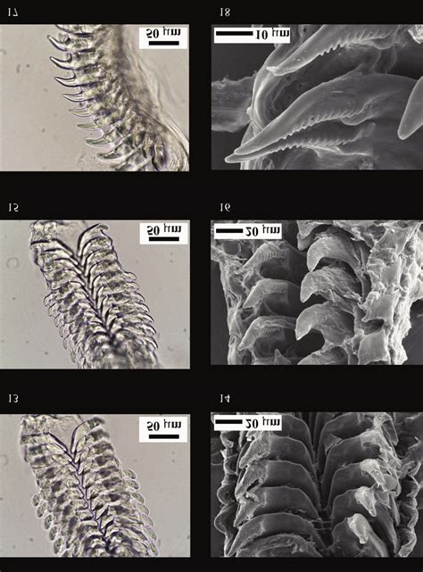Radula Of The Knoutsodonta Pictoni N Sp Figs 13 15 17 Optical
