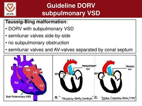 Dorv 医療 Dorv 分類 Jqpgg