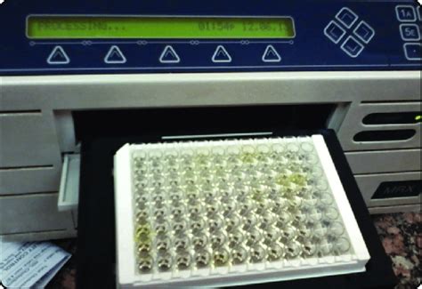 Microplate Reader And Wells Showing Different Optical Density