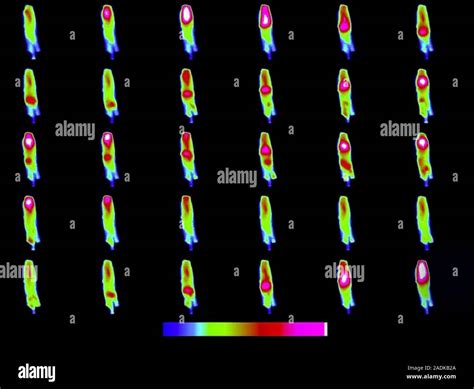Beating Heart Cell Fluorescence Deconvolution Micrograph A