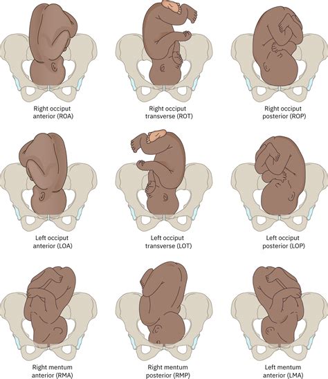 152 Factors Influencing The Process Of Labor And Birth Medicine