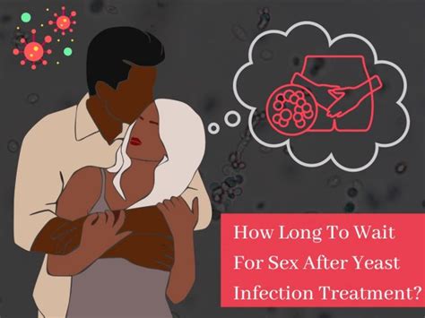 How Long To Wait For Sex After Yeast Infection Treatment The Goodbye Company
