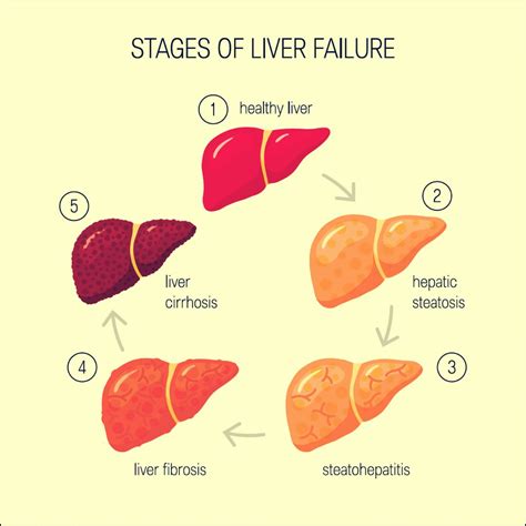 How To Make Your Liver Fail