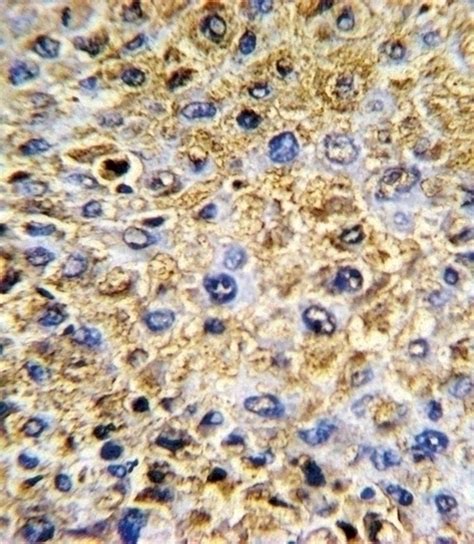 Dcn Antibody Cat No 62 350 Prosci