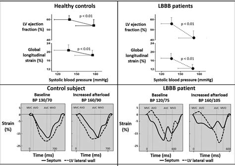 Afterload Hypersensitivity In Lbbb Upper Panels Systolic Function By Download Scientific