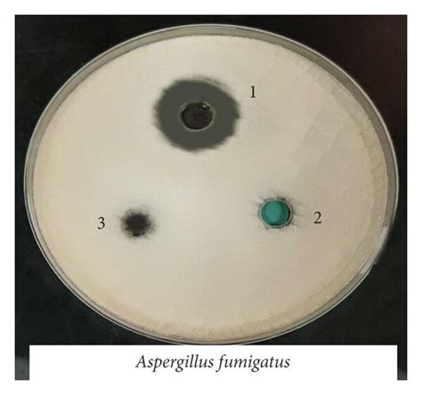 Microbiological Screening Of Ni Ii Cu Ii And Mn Ii Complexes Download Scientific Diagram
