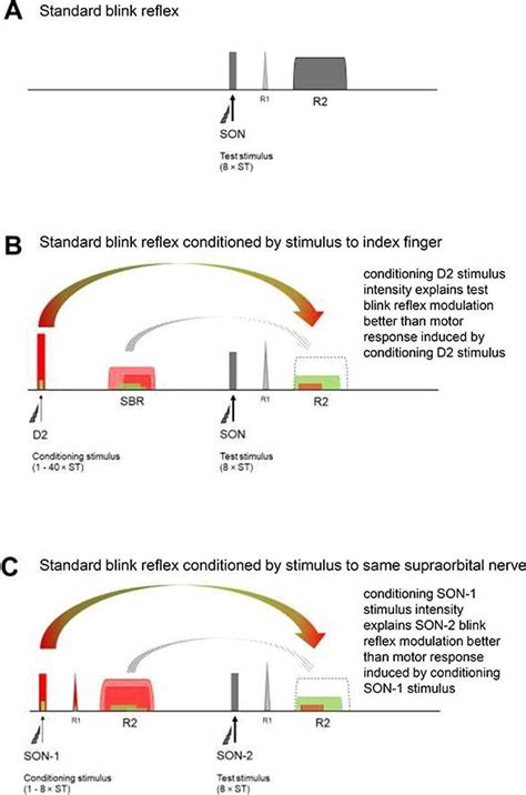 Blink Reflex Kofler Et Al Blink Reflex Modulation Is Clinically