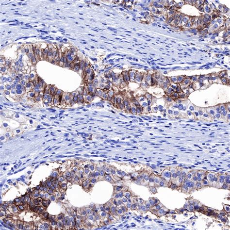 Anti Rabbit And Mouse Hrpanddab Ihc Detection Kit S0c1001 斯达特公司官网