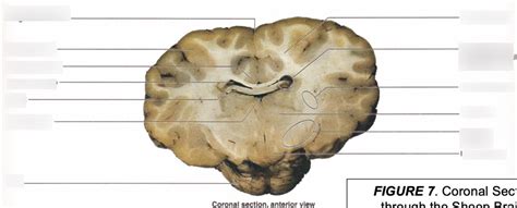 Sheep Brain Diagram Quizlet