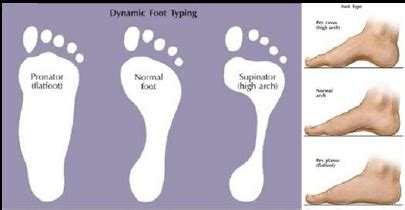 Types Of Foot Arches An Introduction To The Foot