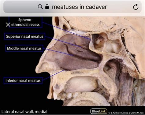 Ethmoid Air Cells Cadaver Ethmoidal Sinus Anatomy Britannica