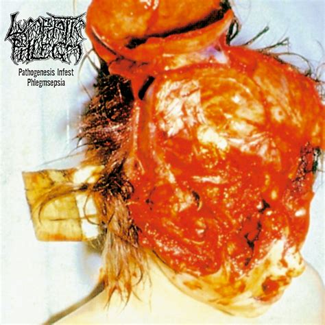 Pathogenesis Infest Phlegmsepsia Lymphatic Phlegm Black Hole