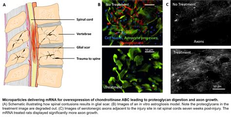 Mrna Therapy Could Break Down Treatment Barriers For Patients With
