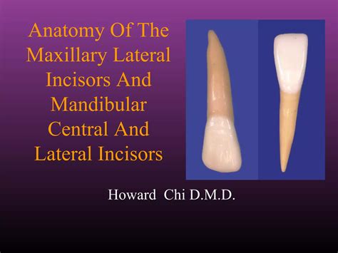 Maxillary Lateral Incisor Anatomy