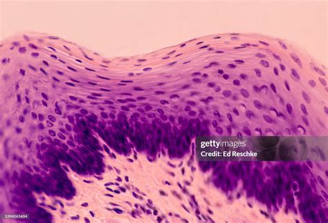 Stratified Squamous Epithelium Non Keratinized Esophagus
