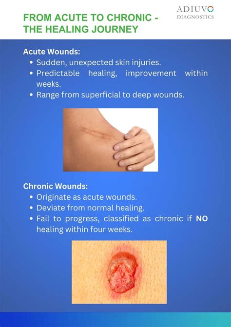 Wound Classification Based On Healing Time Adiuvo Diagnostics Pvt
