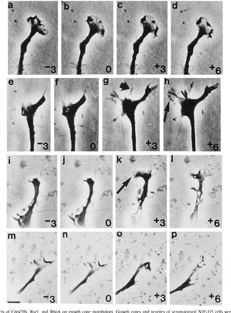 Neuron Projection Development Semantic Scholar