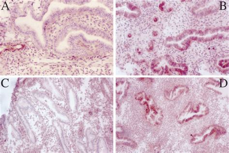 Immunohistochemical Staining Of Integrin α V β 3 In The Mid Secretory