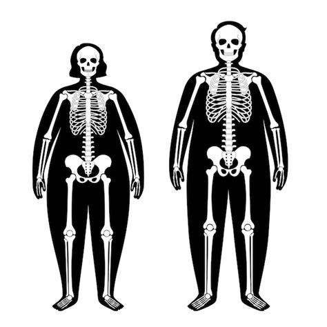 Premium Vector Obese Skeleton Anatomy