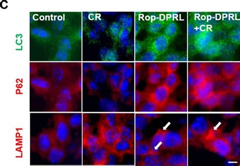 Lc3b Antibody Bsa Free Nb100 2220 By Novus Part Of Bio Techne