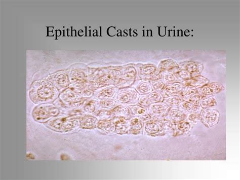 Ppt Urine Microscopy Powerpoint Presentation Id518534