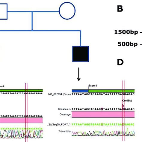 Novel Missense Mutation Identified In Exon 1 Of The Factor Viii Gene