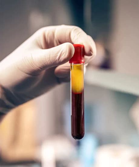 Soft Tissue Biopsy Central Texas Oral Surgery Associates