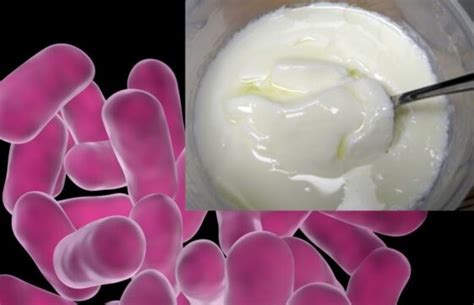 Which Curd Has Probiotics