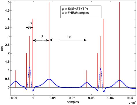 Ecg Synthetic Signal Generated For The Calculation Of A Priori Download Scientific Diagram