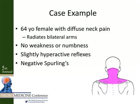 Radiculopathy Vs Peripheral Neuropathy Pdf