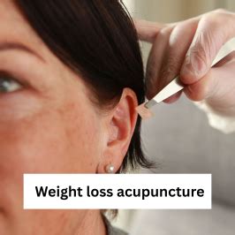 Weight Loss Acupuncture Pro Therapy Scotland