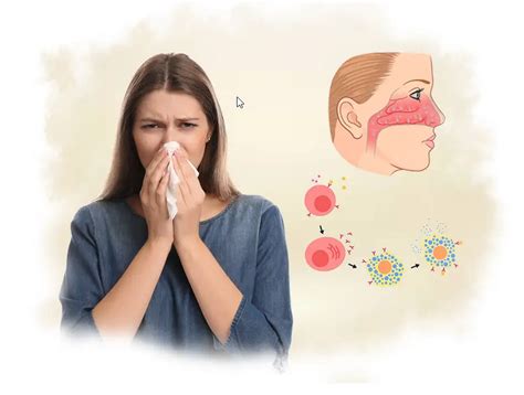 Unveiling Allergic Rhinitis Recognizing And Understanding Its Key Symptoms
