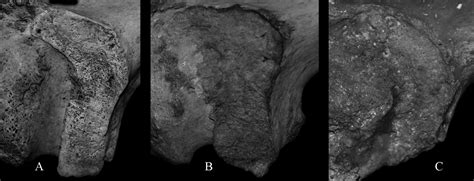 Auricular Surface Age