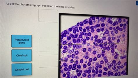 Solved Label The Photomicrograph Based On The Hints