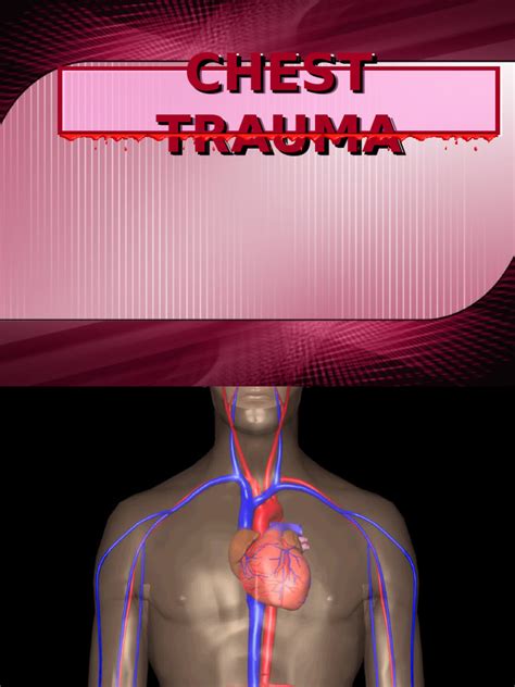 Chest Trauma Basics Pdf Thorax Major Trauma