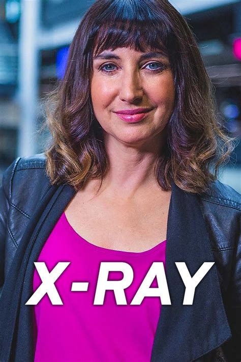 X Ray Pictures Rotten Tomatoes