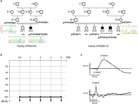 The Cd2 Isoform Of Protocadherin 15 Is An Essential Component Of The