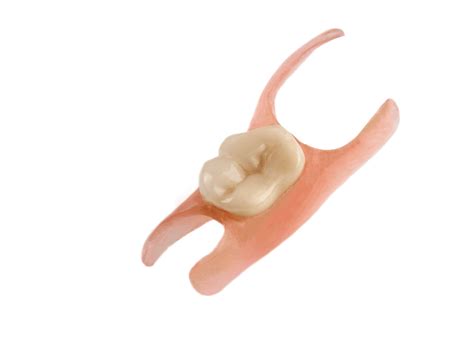 Nesbit Partial Denture Direct Dental Prosthetics