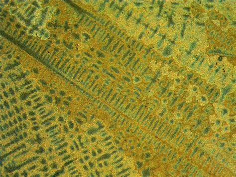 Metallurgical Engineering On Linkedin Microstructure