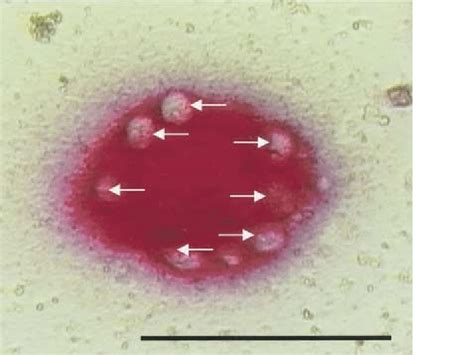 Trap And Multinuclear Fused Cell Arrows Point To Nuclei Scale Bar