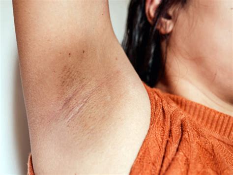 10800 Female Armpit Fotografías De Stock Fotos E Imágenes Libres De
