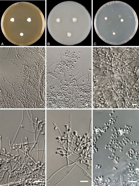 Geomyces Pannorum Atlas Of Clinical Fungi